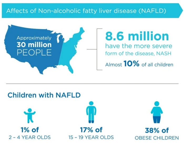 MASLD (Metabolic Dysfunction-Associated Steatotic Liver Disease) in USA ...